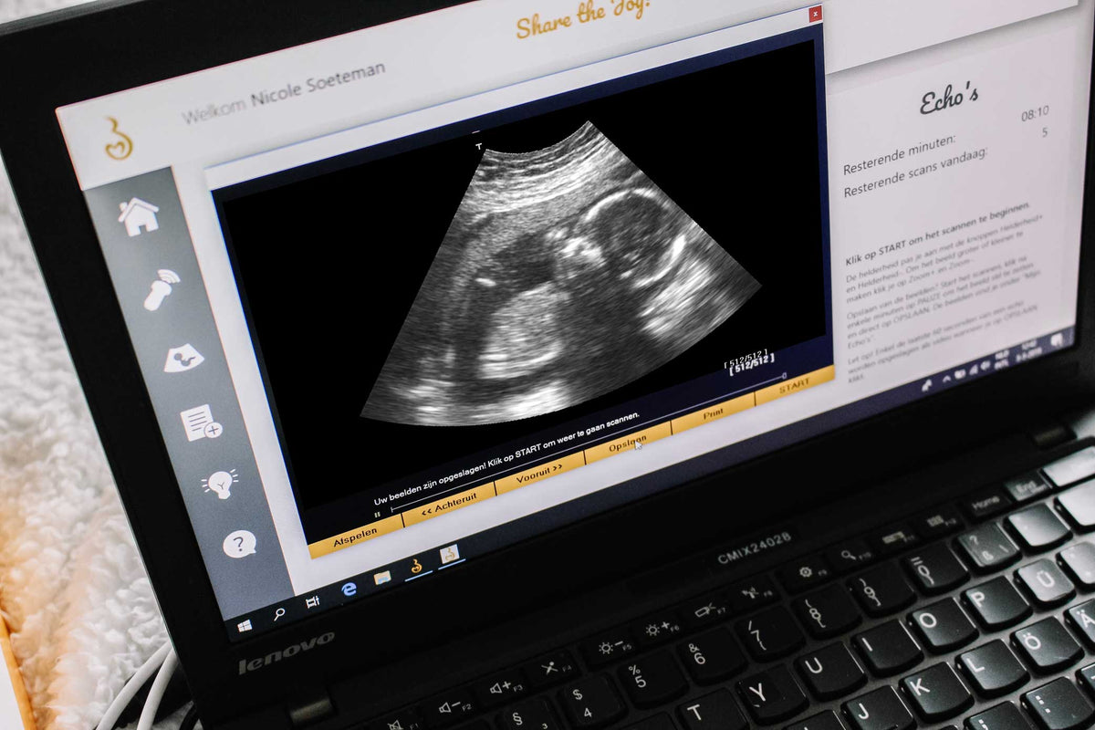 Wat een top uitvinding, die Babywatcher! – lalieloe